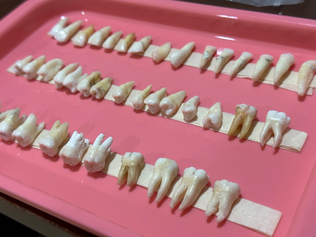 Natural Tooth Specimens, Health & Nutrition, Medical Supplies & Tools ...