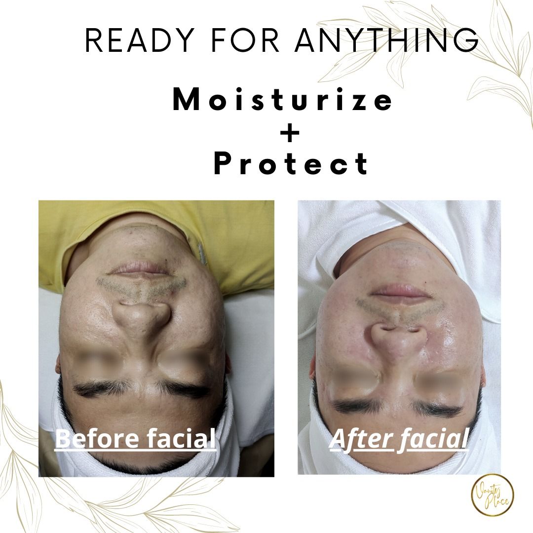 Home based Facial @ Jurong West | Acne | Anti Aging | Bojin | Hydrating ...