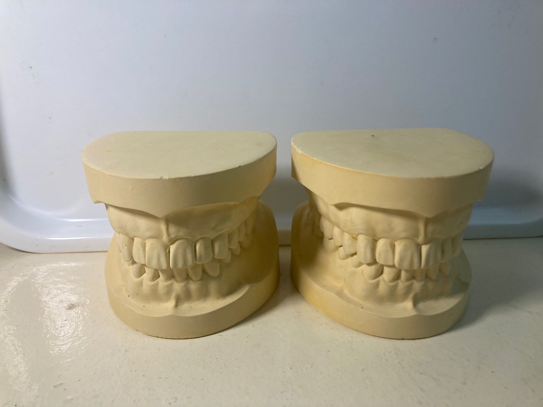 Dentulous Cast on Carousell