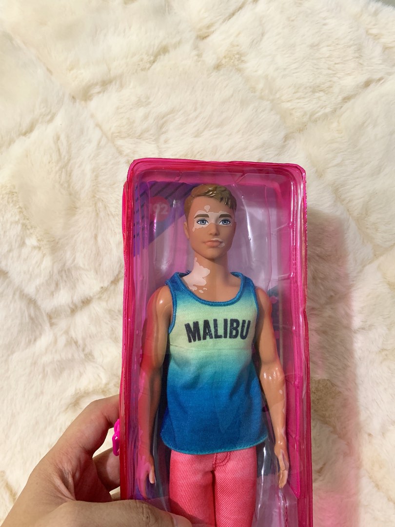 Barbie Doll | Vitiligo Ken | Barbie Fashionista 192, Hobbies & Toys ...