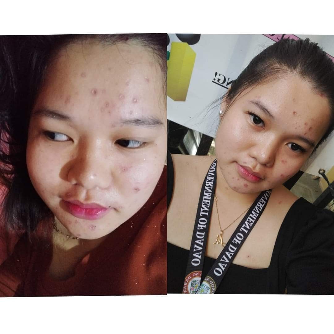 Glowrie Bleaching Soap (7 bars LIMITED EDITION), Beauty & Personal Care ...