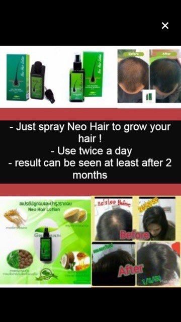 Neo Hair Lotion Original Bangkok Factory, Beauty & Personal Care, Hair ...