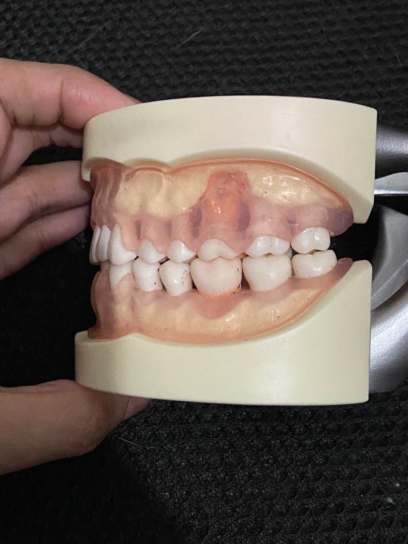 Nissin Periodontal Jaw / Perio Jaw/ Periodontal Study Model, Beauty ...