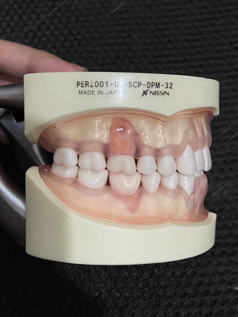 Nissin Periodontal Jaw / Perio Jaw/ Periodontal Study Model, Beauty ...