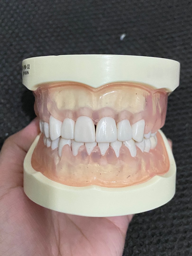 Nissin Periodontal Jaw / Perio Jaw/ Periodontal Study Model, Beauty ...