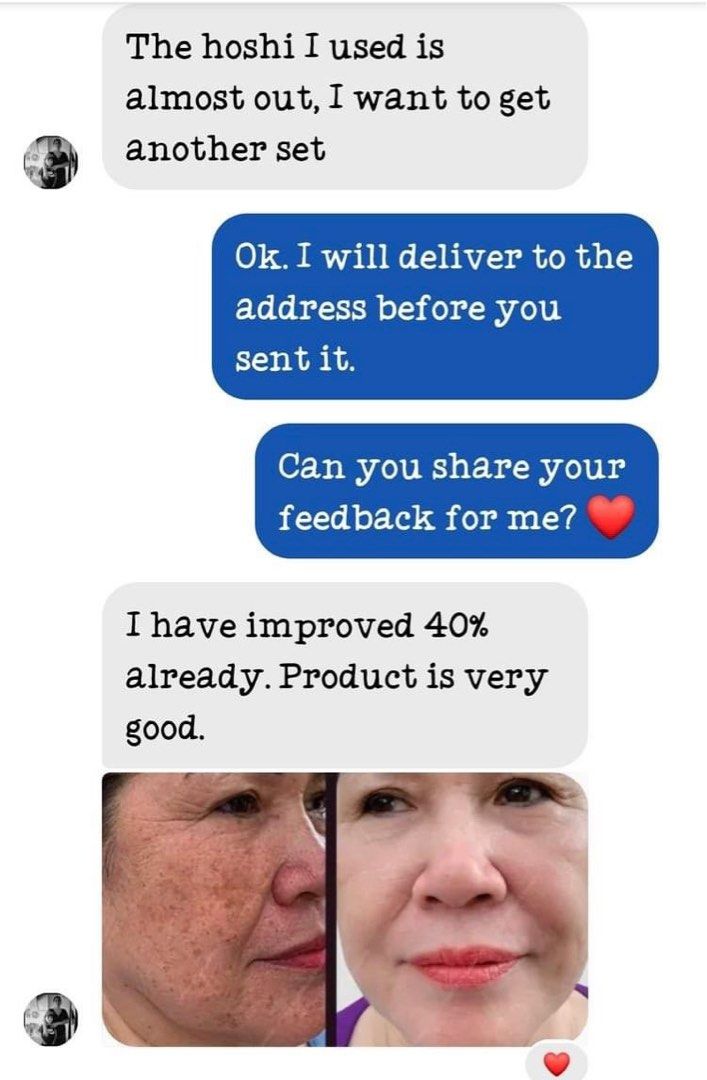 Hoshi Japanese cream, Beauty & Personal Care, Face, Face Care on Carousell