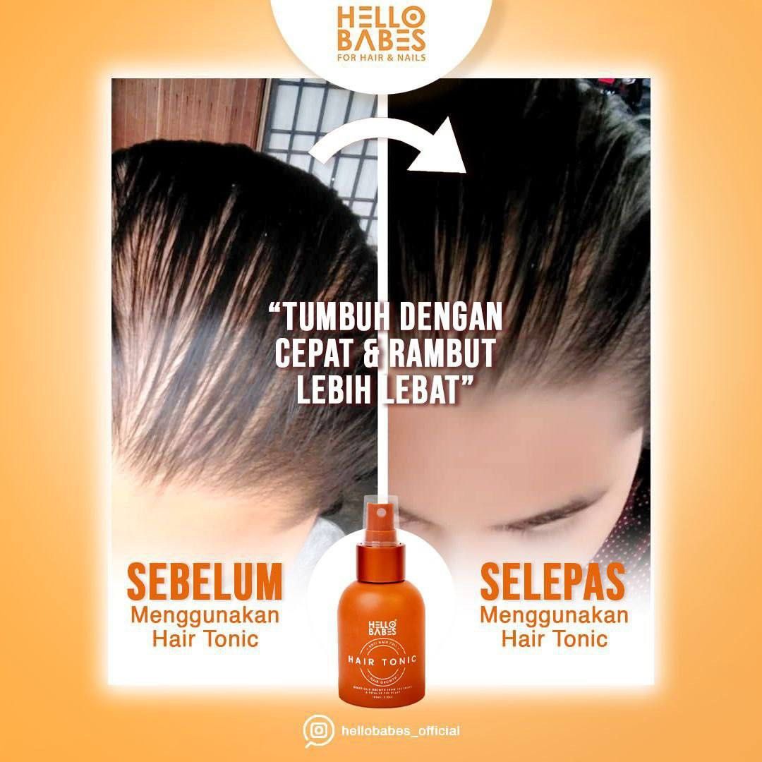Hellobabes Hair Tonic, Beauty & Personal Care, Hair on Carousell