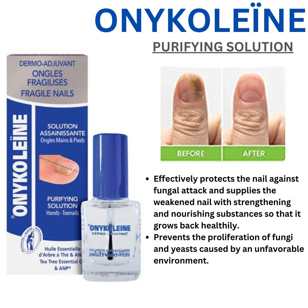 ONYKOLEINE FUNGUS SOLUTION 10ml, Beauty & Personal Care, Hands & Nails ...