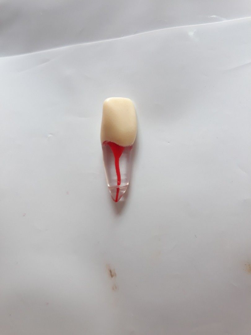 Endodontic Transparent Tooth Model Monorooted #21, Health & Nutrition ...