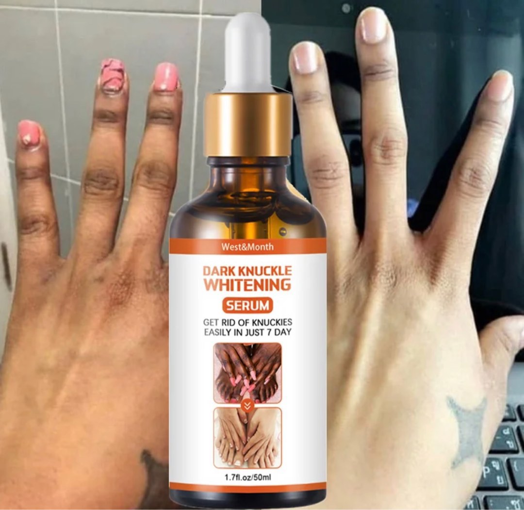 Knuckles Whitening Cream, Beauty & Personal Care, Bath & Body, Body ...
