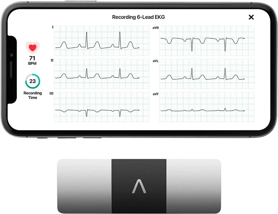 2205) ALIVECOR KARDIAMOBILE 6L | FDA-CLEARED | WIRELESS 6-LEAD EKG ...