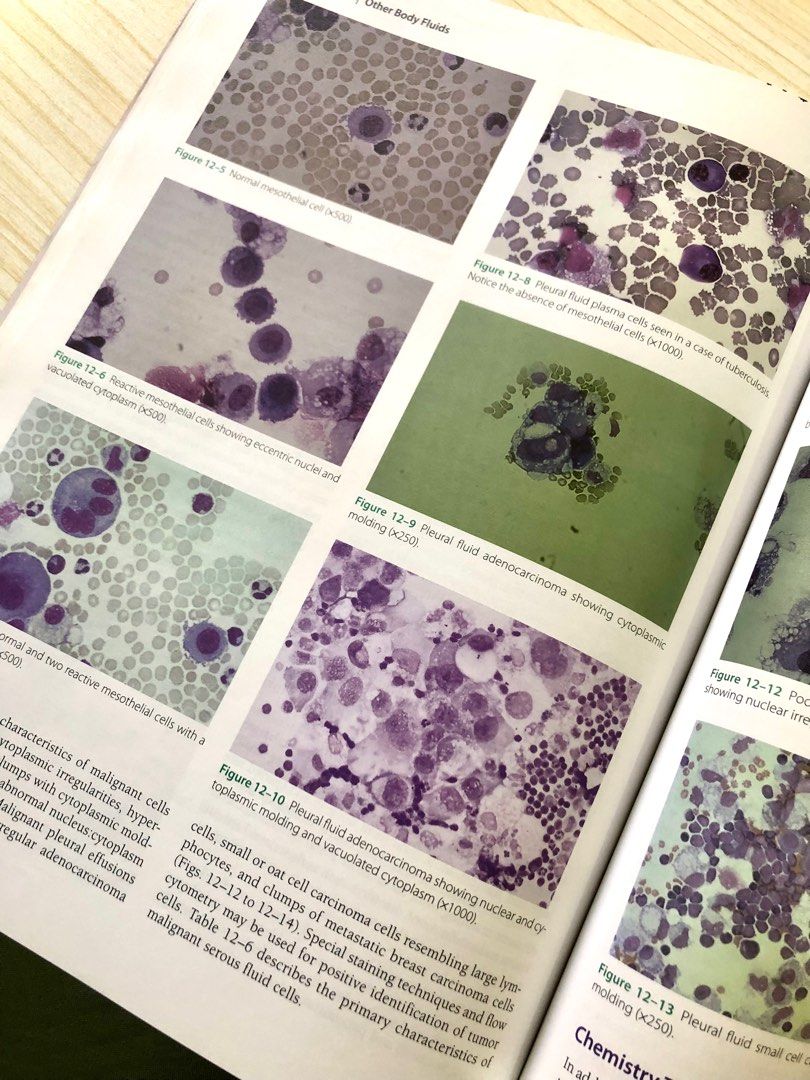 AUBF Clinical Microscopy - Strasinger 6th ed., Hobbies & Toys, Books ...