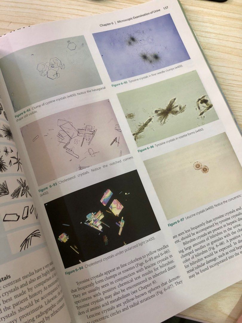 AUBF Clinical Microscopy - Strasinger 6th ed., Hobbies & Toys, Books ...