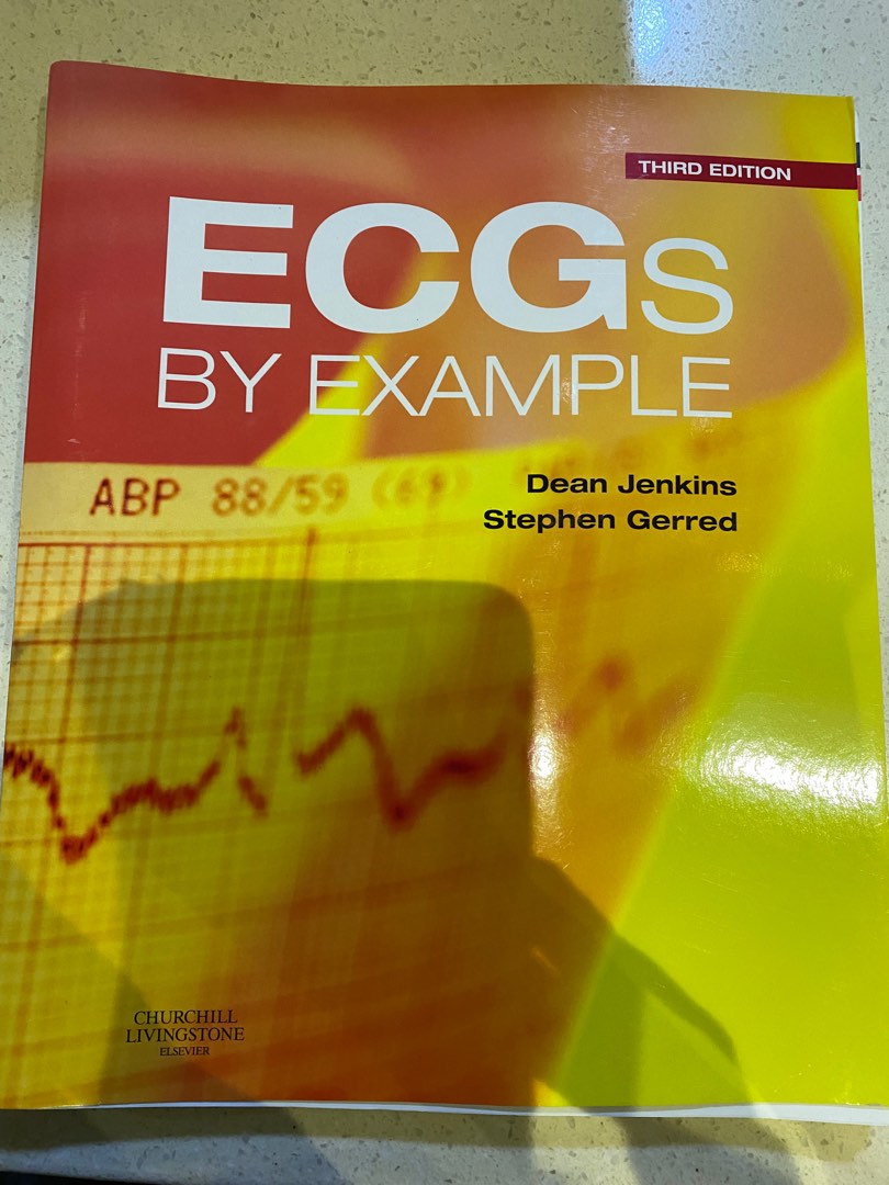 ECGs by example, Hobbies & Toys, Books & Magazines, Textbooks on Carousell