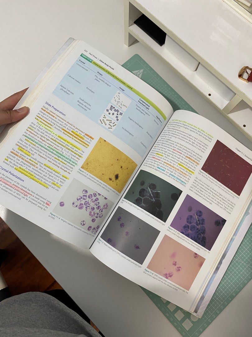 Urinalysis and Body Fluids 6th Ed by Strasinger, Hobbies & Toys, Books ...