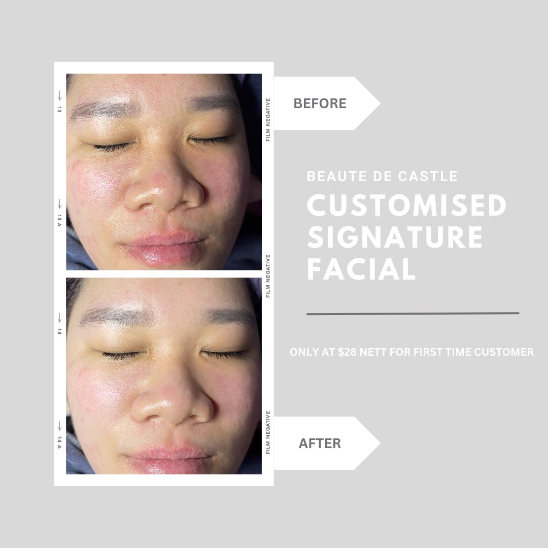 Customised Signature Facial Trial @ $28, Beauty & Personal Care, Face ...