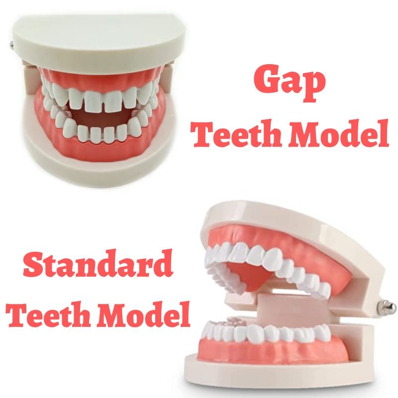 Standard Teeth Model Adult Standard Typodont Demonstration Denture ...