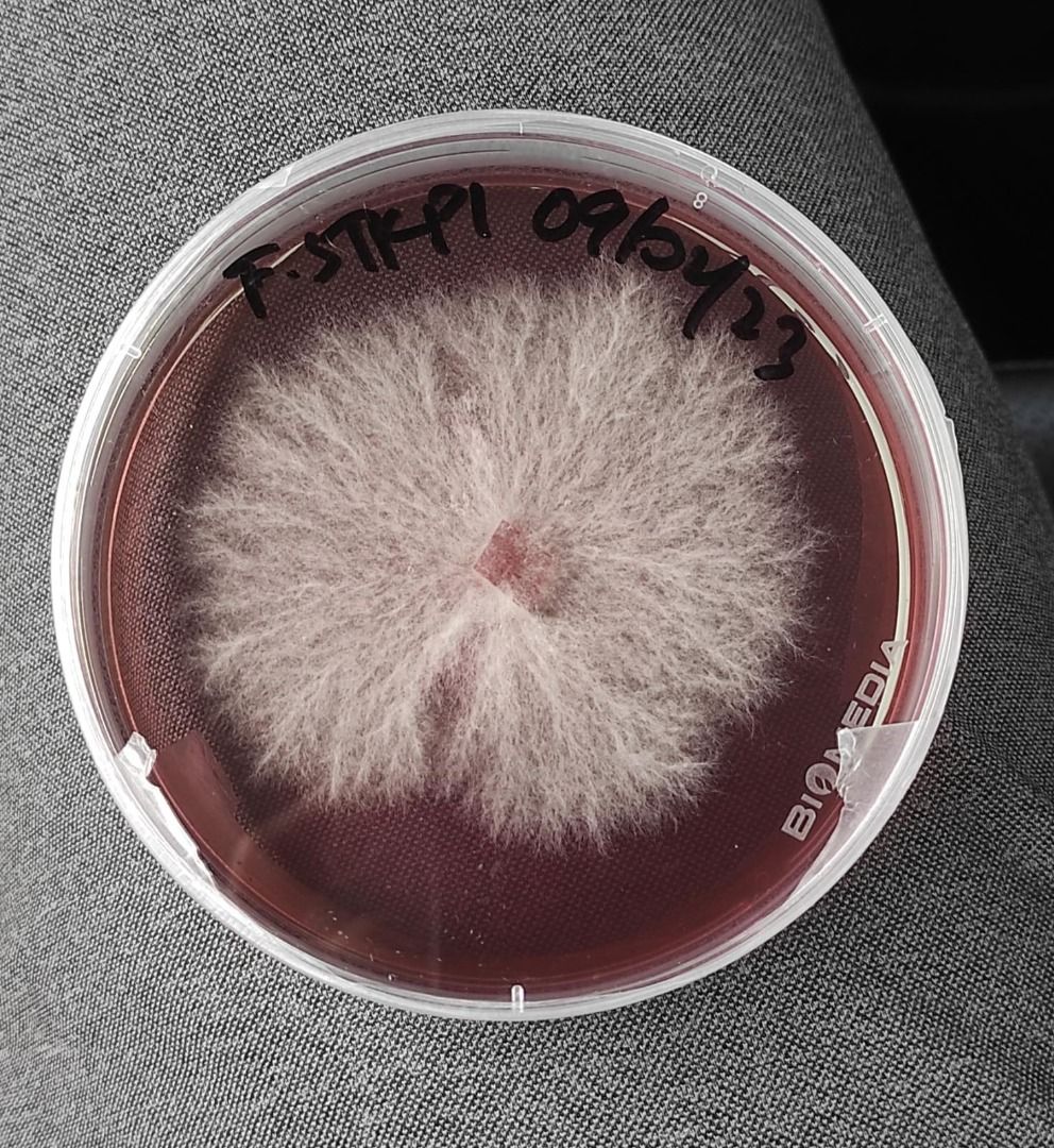 Mycelium culture, various edible species, Furniture & Home Living ...