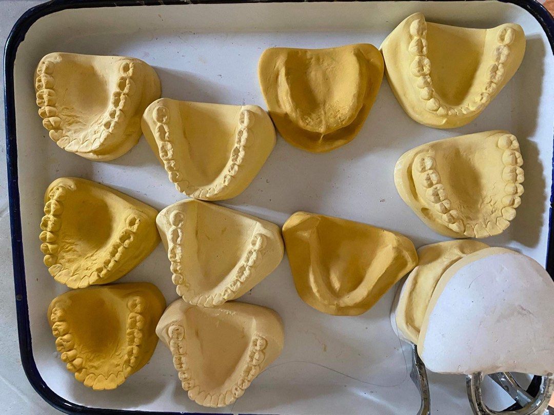 RPD and CD Casts on Carousell