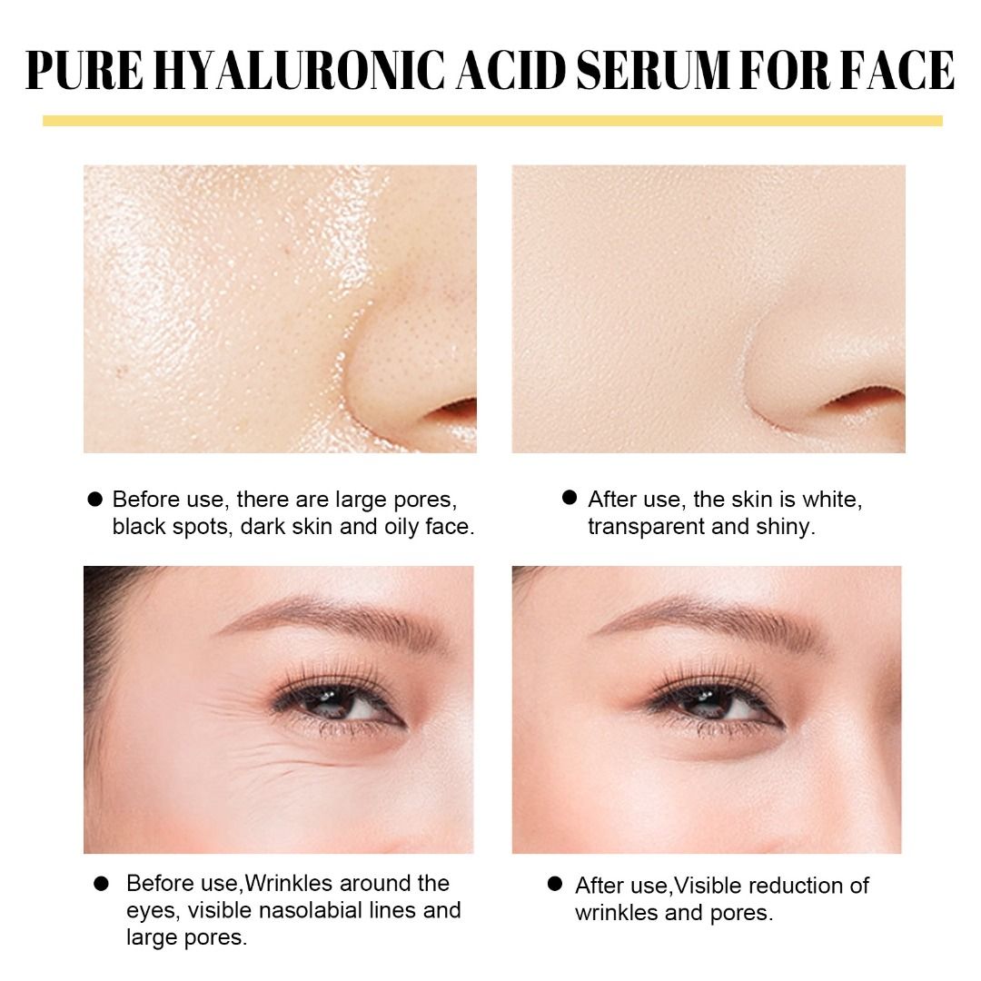 CLEARANCE SALE -Gold Protein Thread Face Lifter with Free Serum, Anti ...