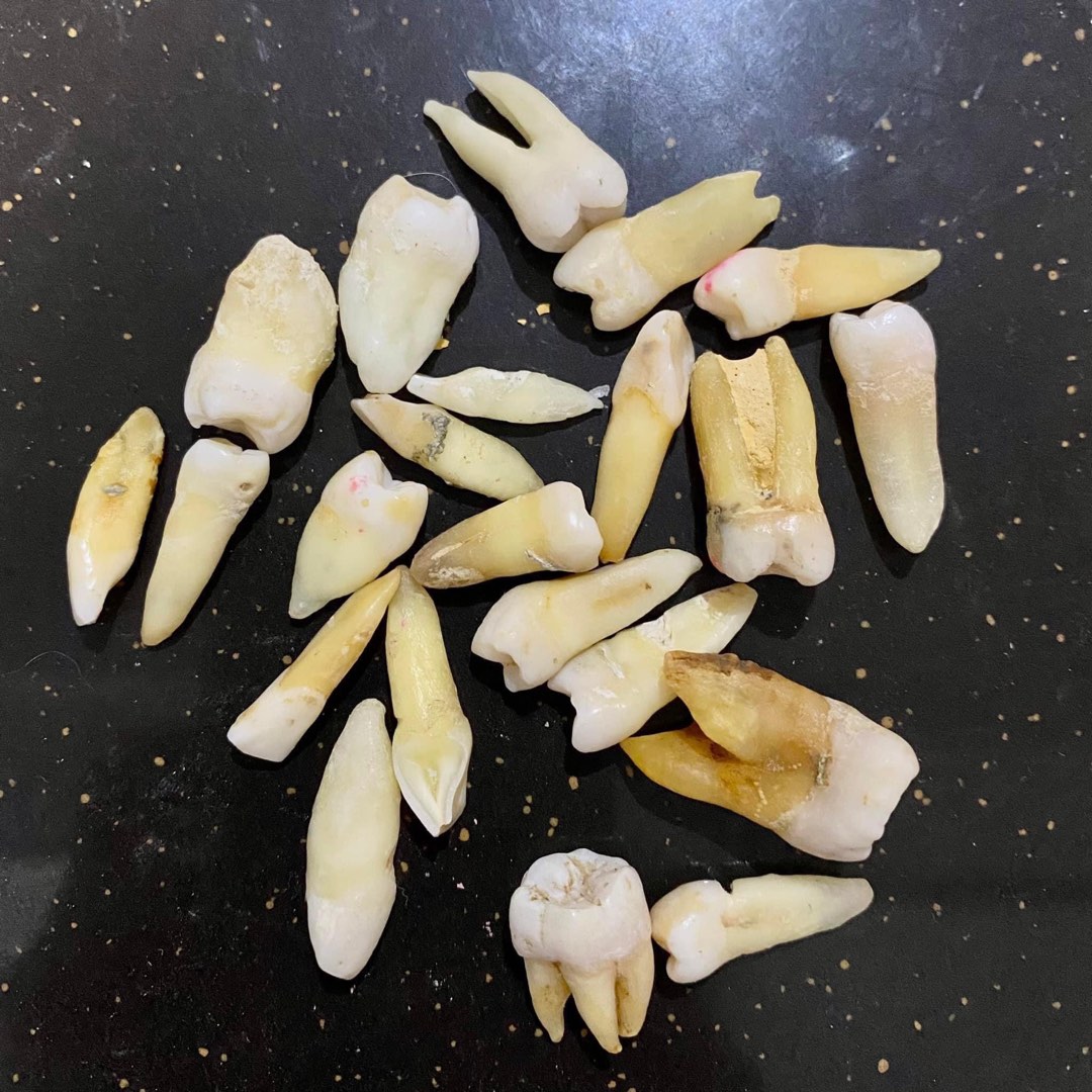 NATURAL TOOTH SPECIMEN on Carousell