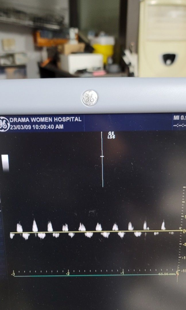 Ge 2d echo ultrasound machine, Health & Nutrition, Medical Supplies ...