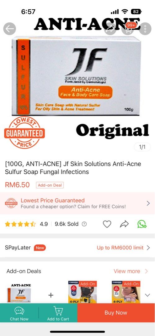 JF skin solution anti acne soap, Beauty & Personal Care, Bath & Body ...