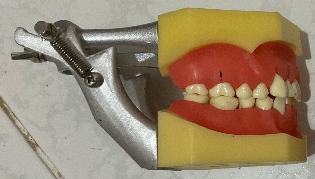 Perio Jaw Model, Health & Nutrition, Medical Supplies & Tools on Carousell