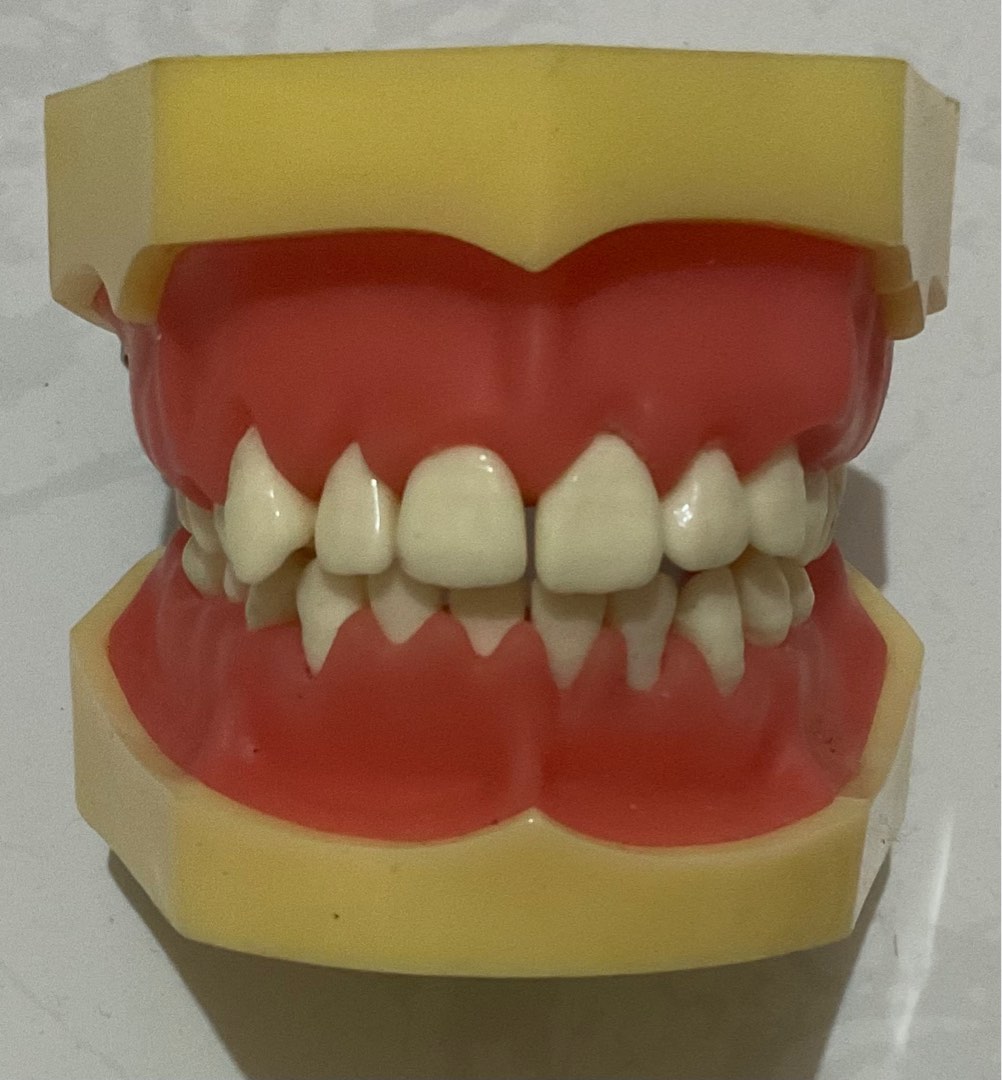 Perio Jaw Model, Health & Nutrition, Medical Supplies & Tools on Carousell