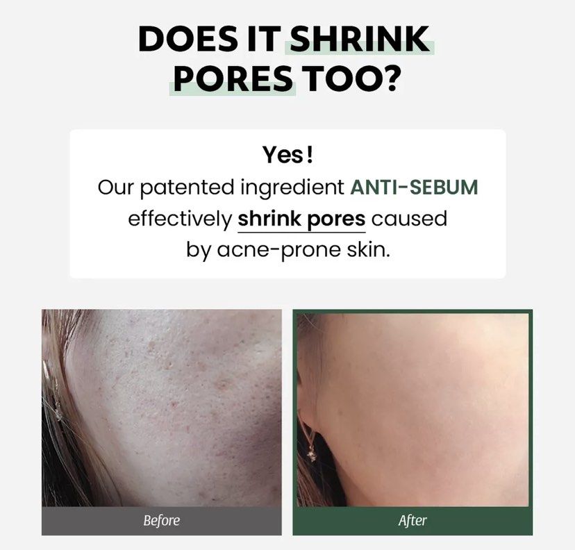 [ Blanc Nature Official ] Acne Pimple Face Cleanser Cleansing foam ...