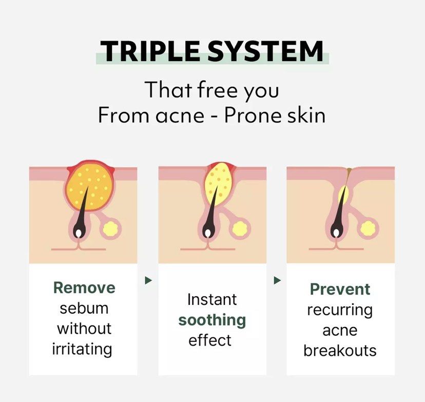 [ Blanc Nature Official ] Acne Pimple Face Cleanser Cleansing foam ...