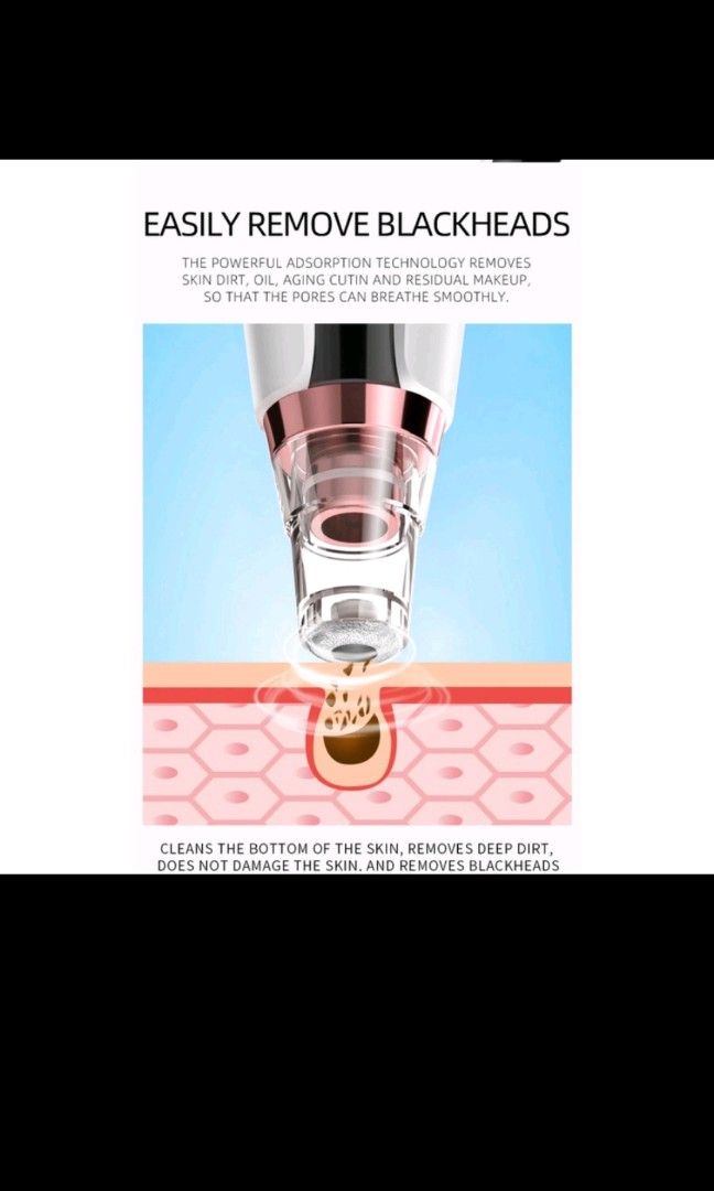 Blackhead Removal Suction, Beauty & Personal Care, Face, Face Care on ...