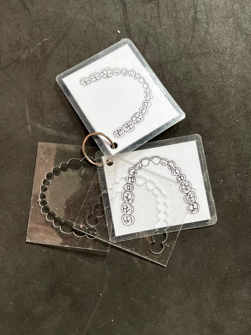 RPD stencil for deawing and tracing, Health & Nutrition, Medical ...