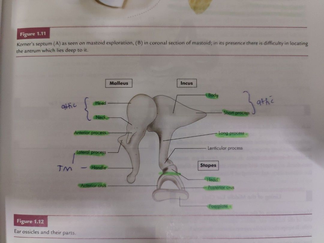 Diseases of Ear, Nose & Throat (ENT)- Dhingra | Medical book for ...