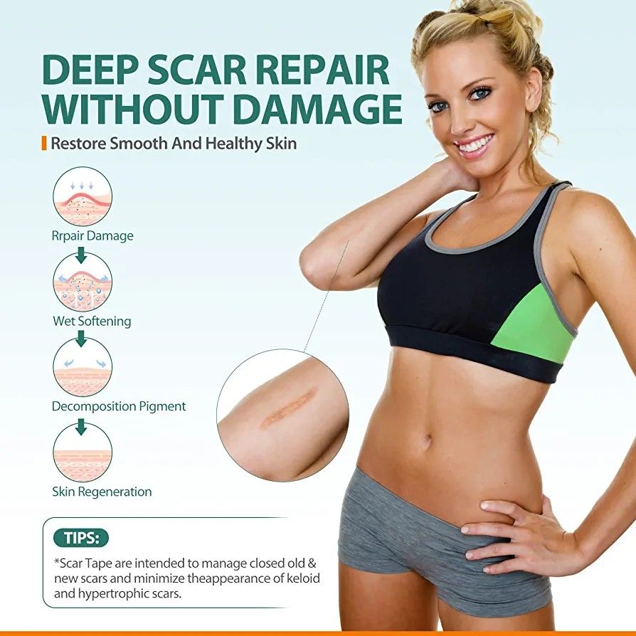 c section scar removal