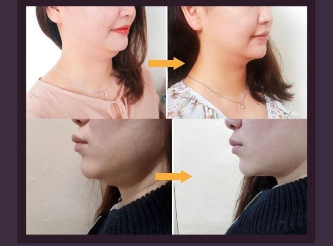 MURO Coco Nenne Band V Shape Line Facial Lifting Sleeping Resilience ...