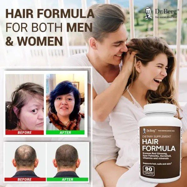 Dr. Berg Hair Formula, 健康及營養食用品, 健康補充品, 健康補充品 - 維他命及補充品 - Carousell