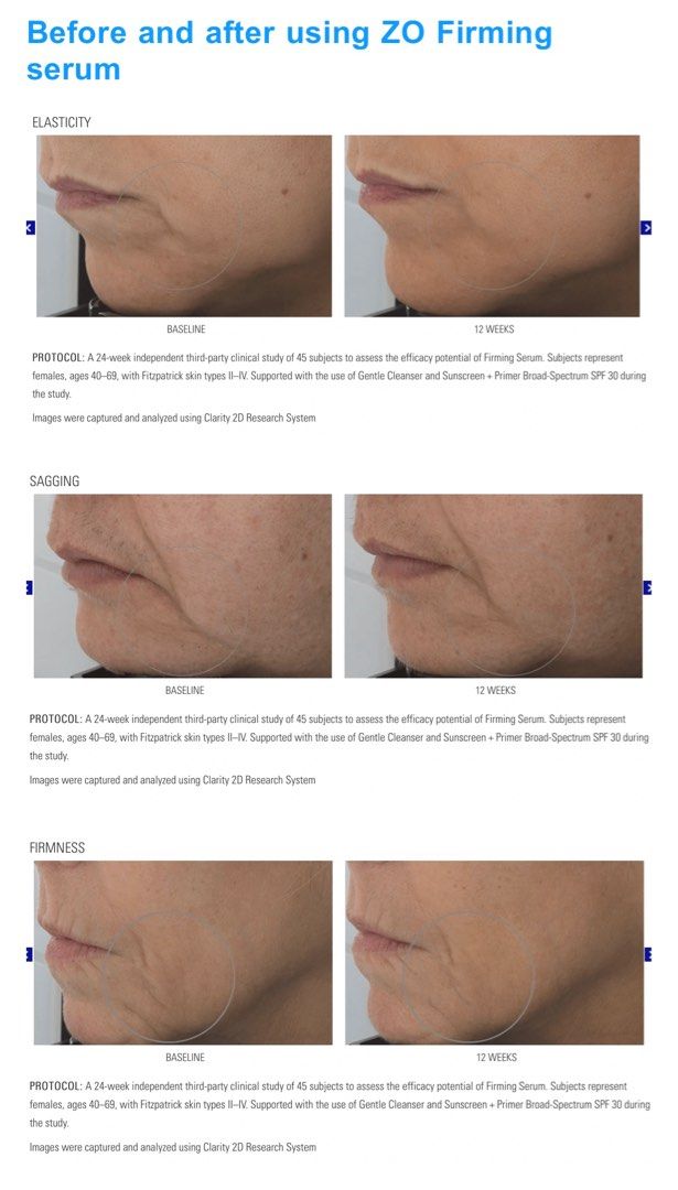Zein Obagi ZO Skin Health Firming Serum on Carousell
