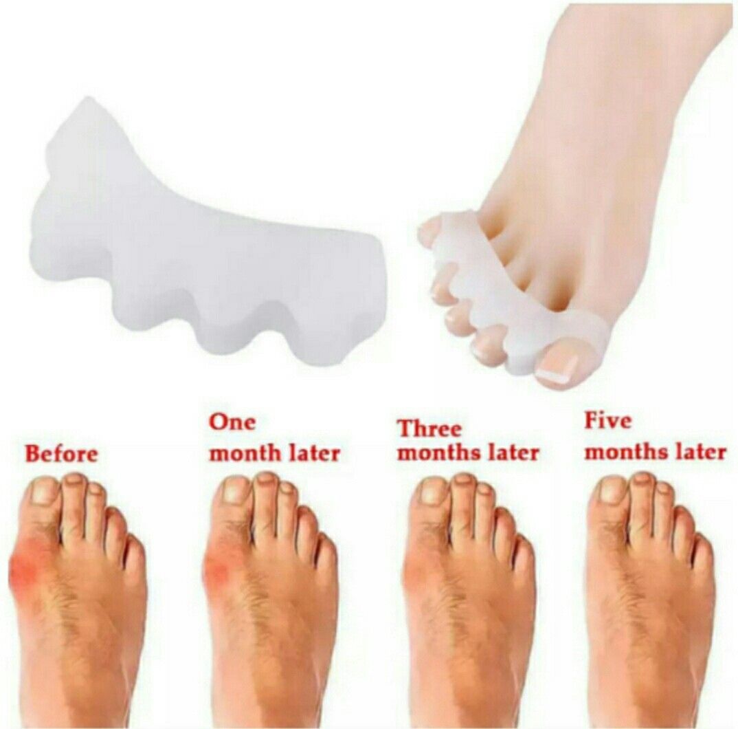 Reduce friction between toes, Beauty & Personal Care, Foot Care on ...
