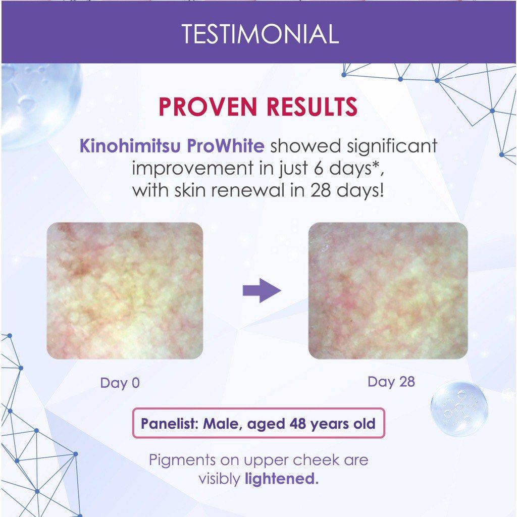 Kinohimitsu ProWhite 1 box 30s, Health & Nutrition, Health Supplements ...