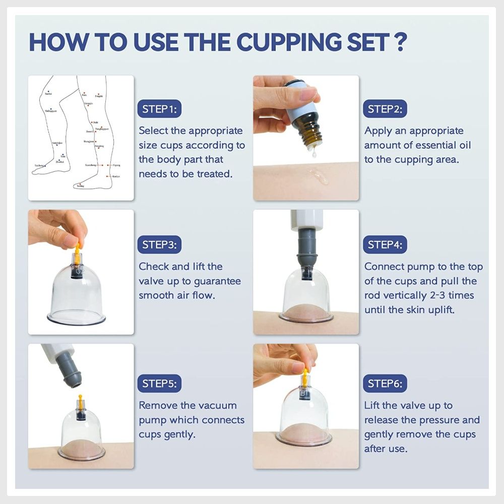 KingPavonini 32 Cups Cupping Therapy Set, Professional Chinese Cupping ...