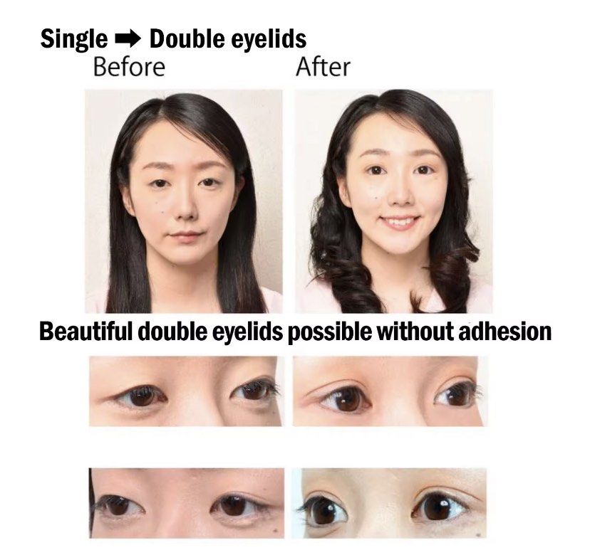 Ledouble - Double eyelid forming liquid - Double eyelid glue (2mL), Beauty & Personal Care, Face ...