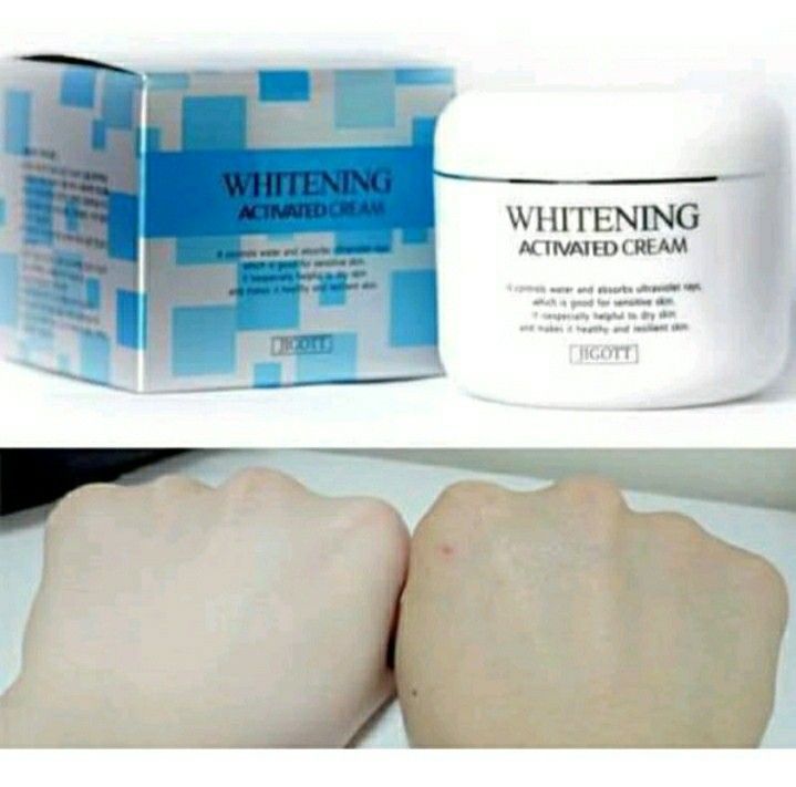 Authentic Jigott whitening Activated Cream, Beauty & Personal Care ...