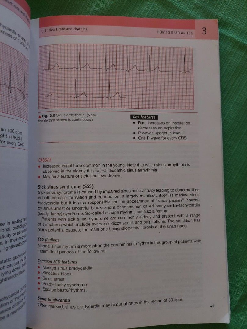 ECG complete, Hobbies & Toys, Books & Magazines, Textbooks on Carousell