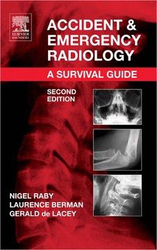 MRCS Textbook - Accident & energency radiology 2nd edition, Hobbies ...
