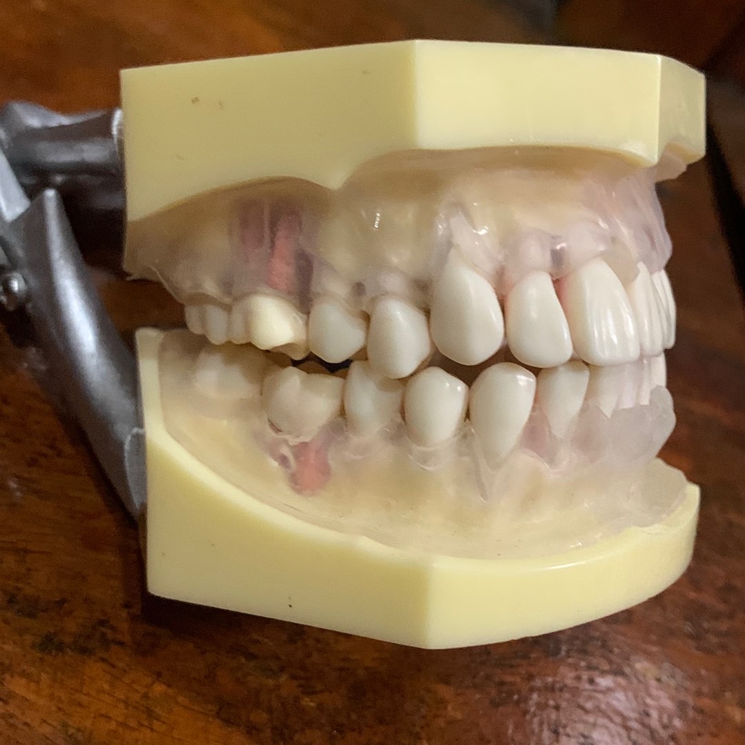 Perio Jaw on Carousell