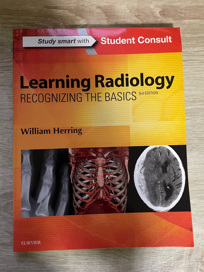 Learning Radiology Recognising The Basics 3rd Edition, Hobbies & Toys ...