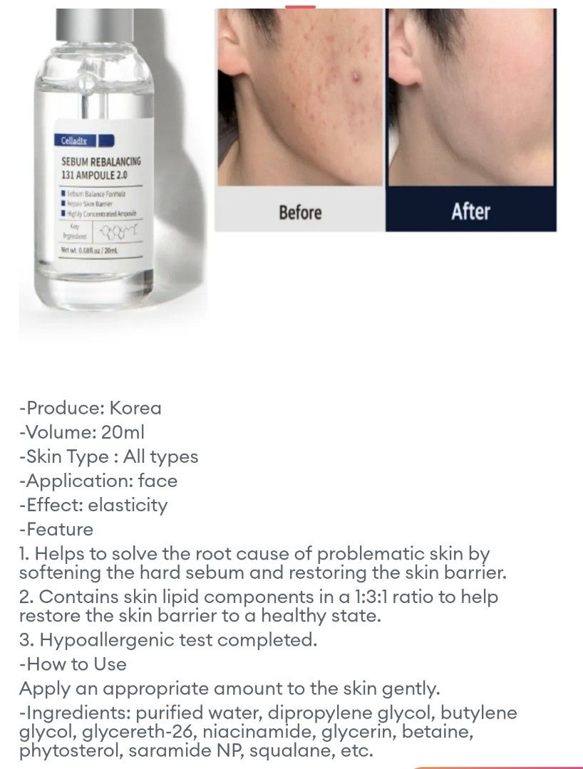 Celladix Sebum Rebalancing RX 131 Ampoule (1 box/$35, 2 boxes and above ...