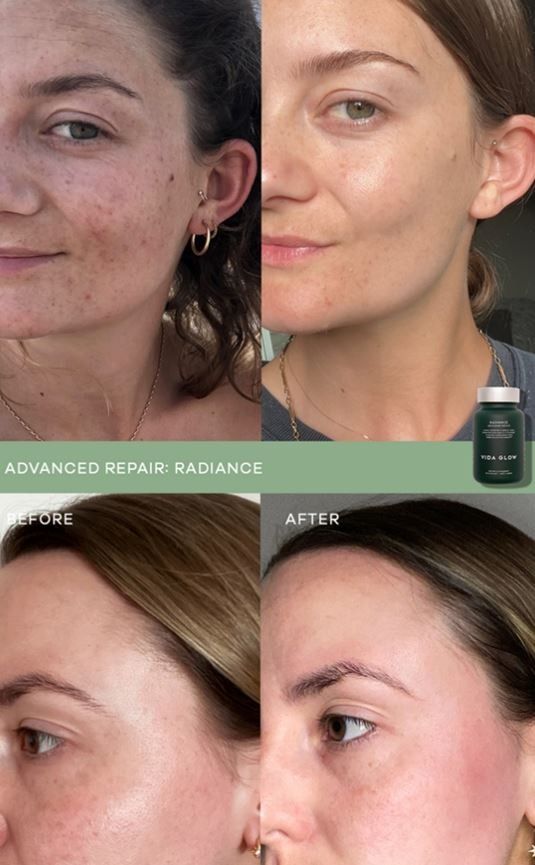 Vida Glow Radian (ready stock), Beauty & Personal Care, Face, Face Care ...