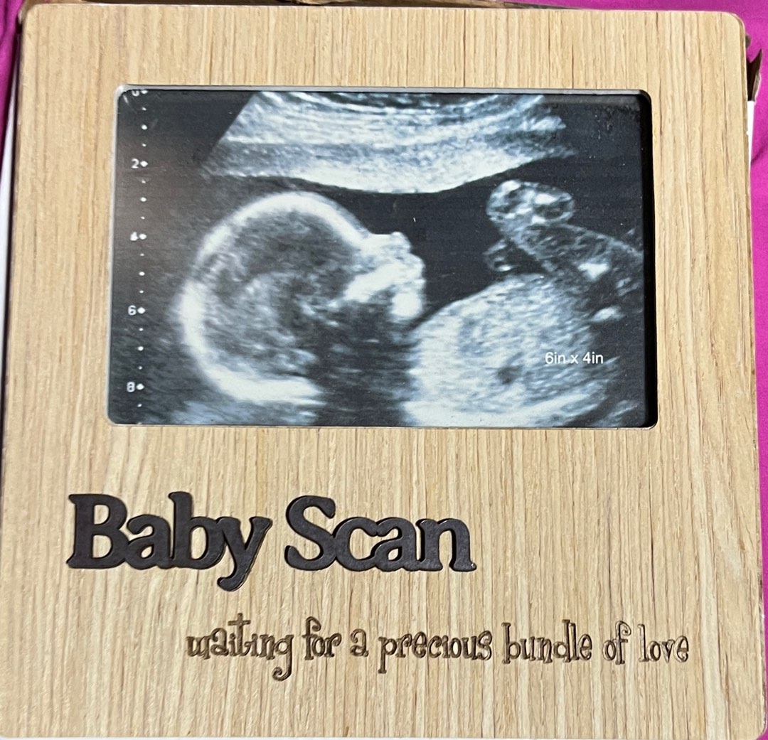 Free Baby scan frame, Furniture & Home Living, Home Decor, Frames ...